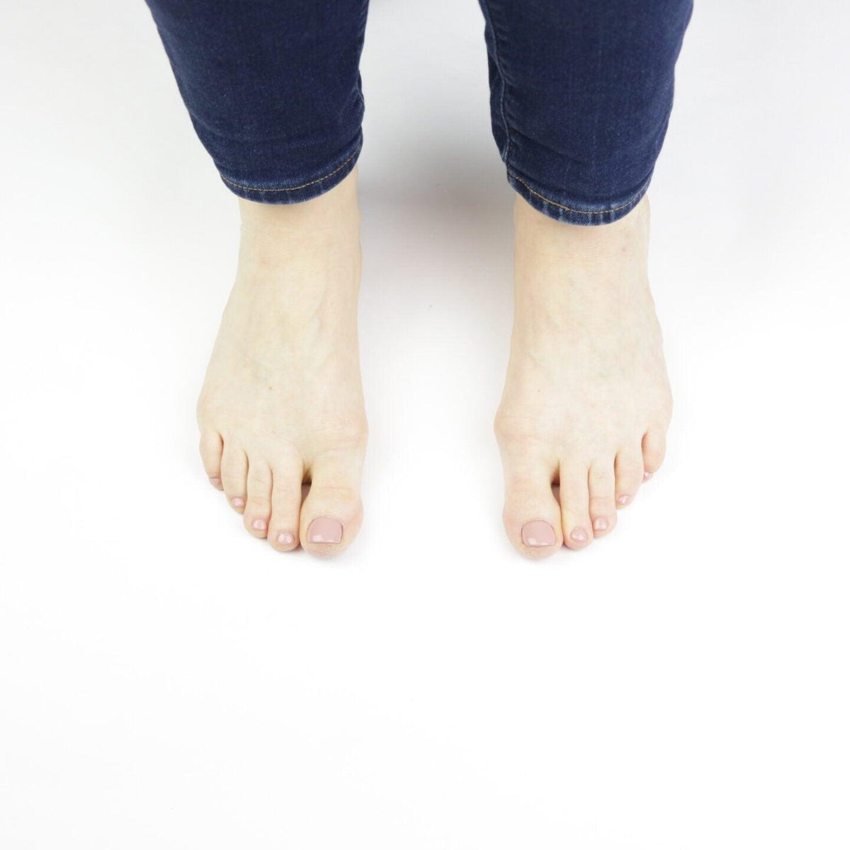 Pincer Toenails: Causes, Prevention, and Treatment Options– Correct Toes